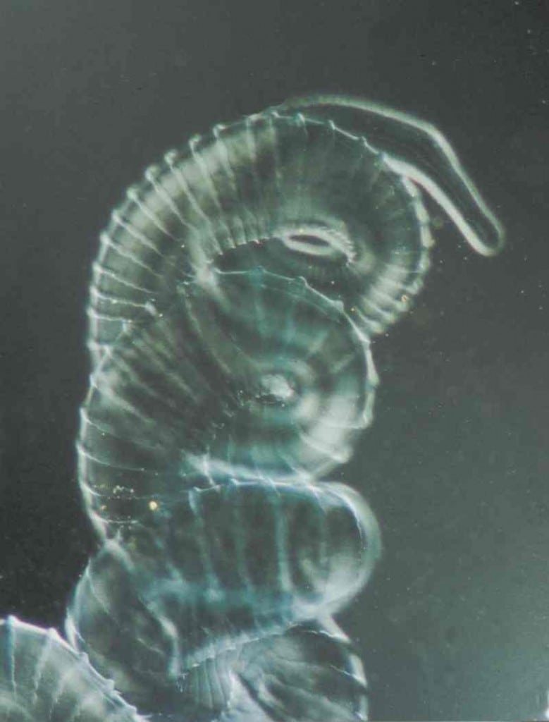 Onchocerca gutturosa male (A. Renz) - Programme Onchocercoses